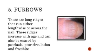 Nail Diseases.pptx