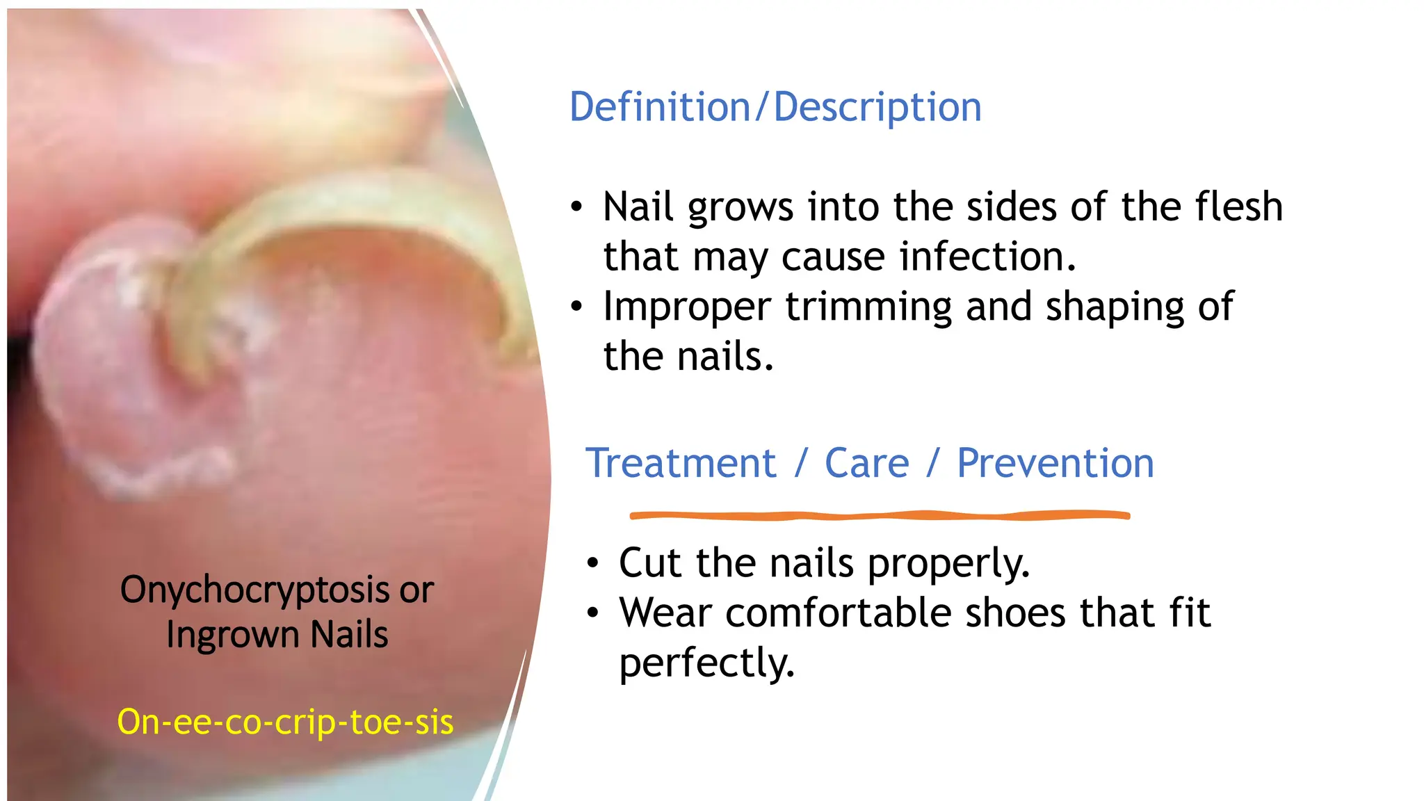 Nail diseases.pptx