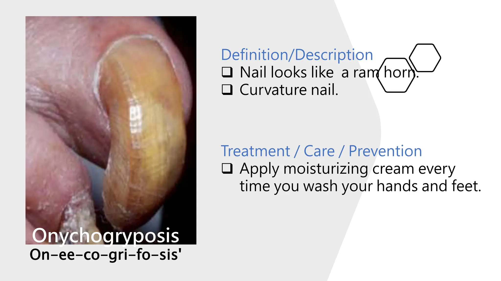 Nail diseases.pptx