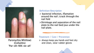 Nail diseases.pptx