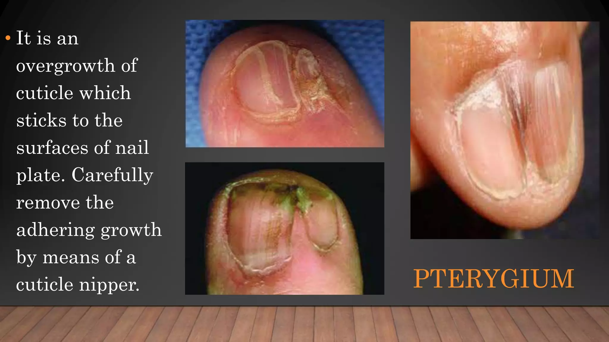 Nail diseases and disorders | PPTX | Nail Care | Beauty