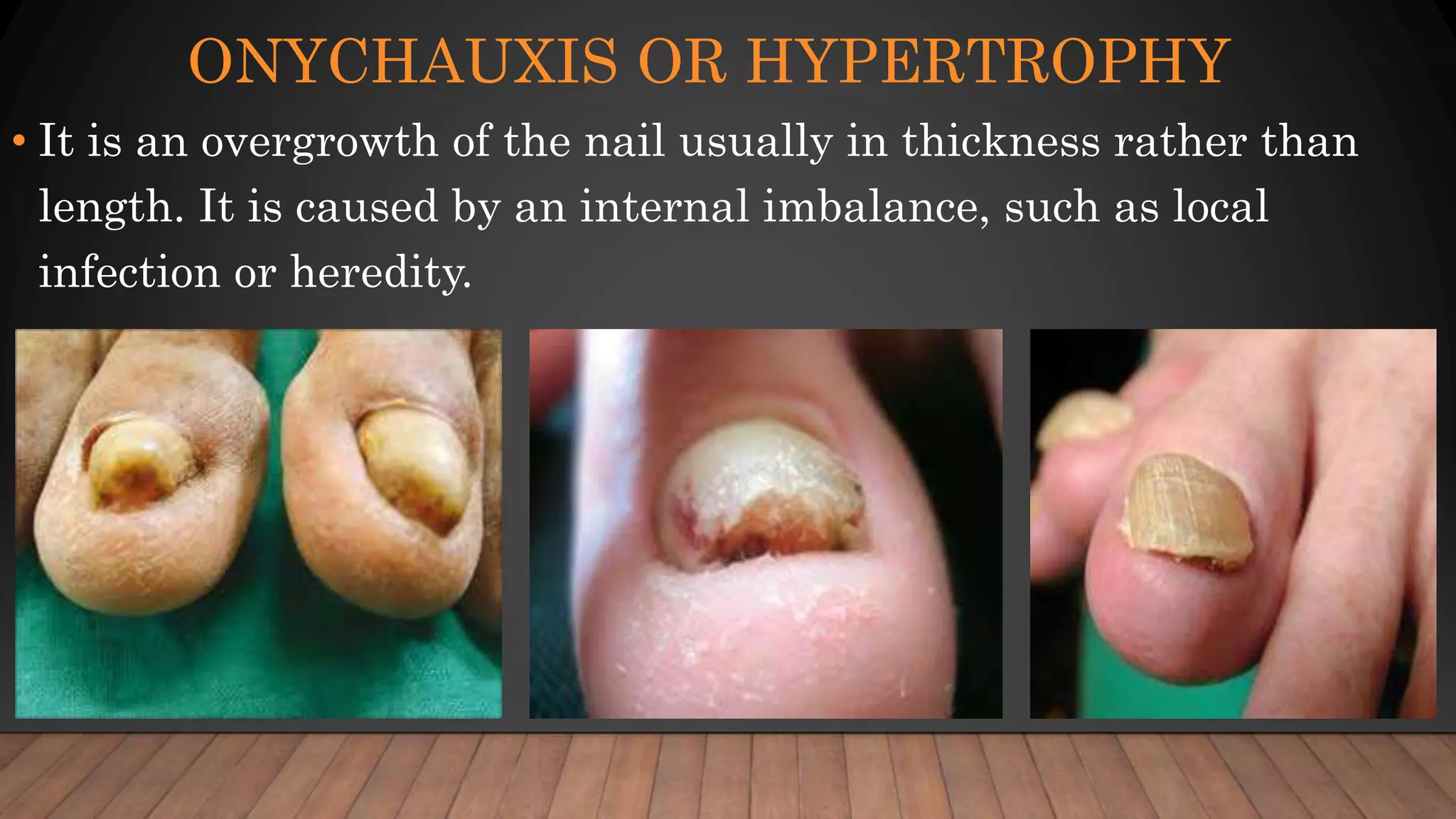 Nail diseases and disorders | PPTX