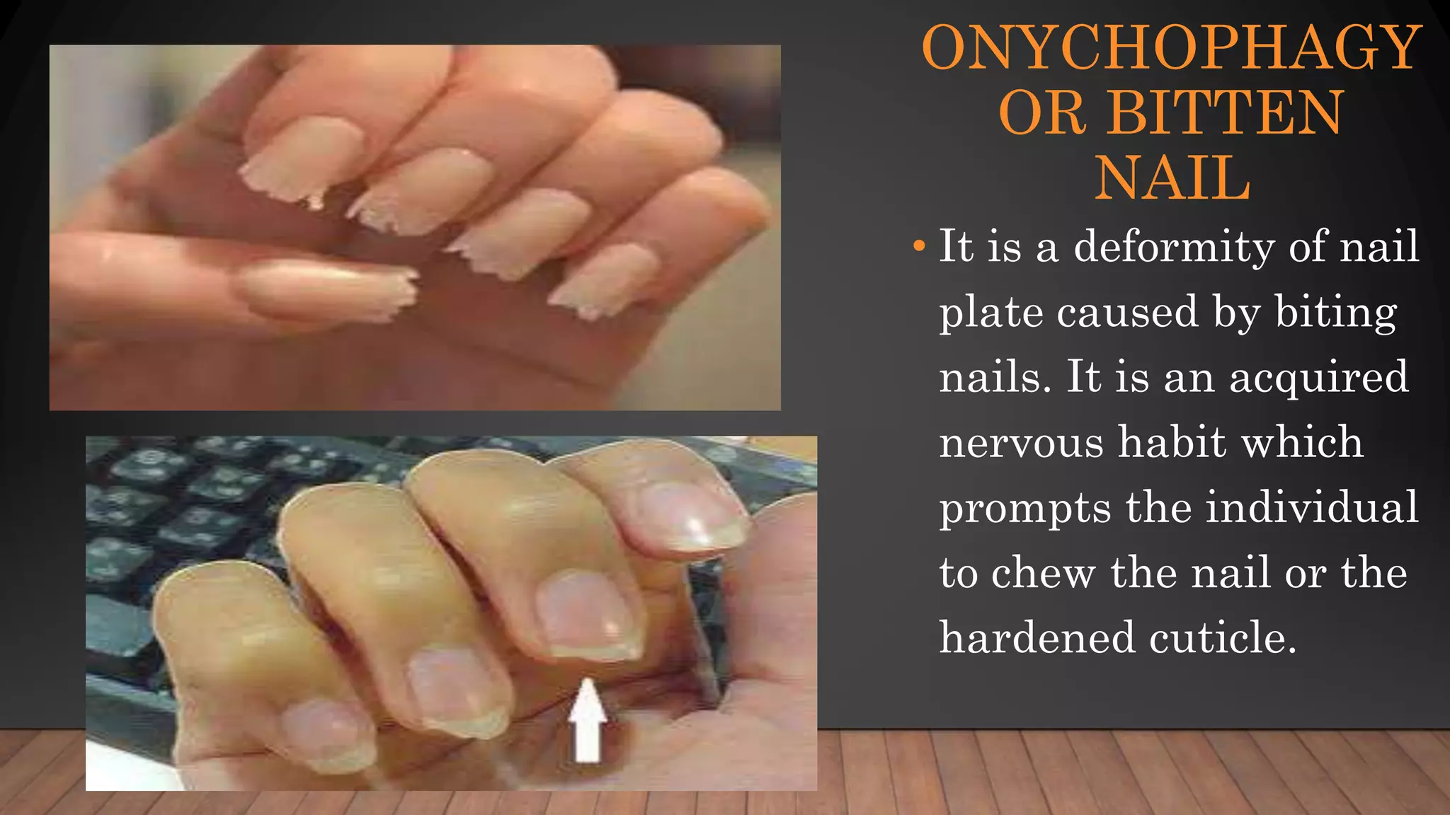 Nail diseases and disorders | PPTX