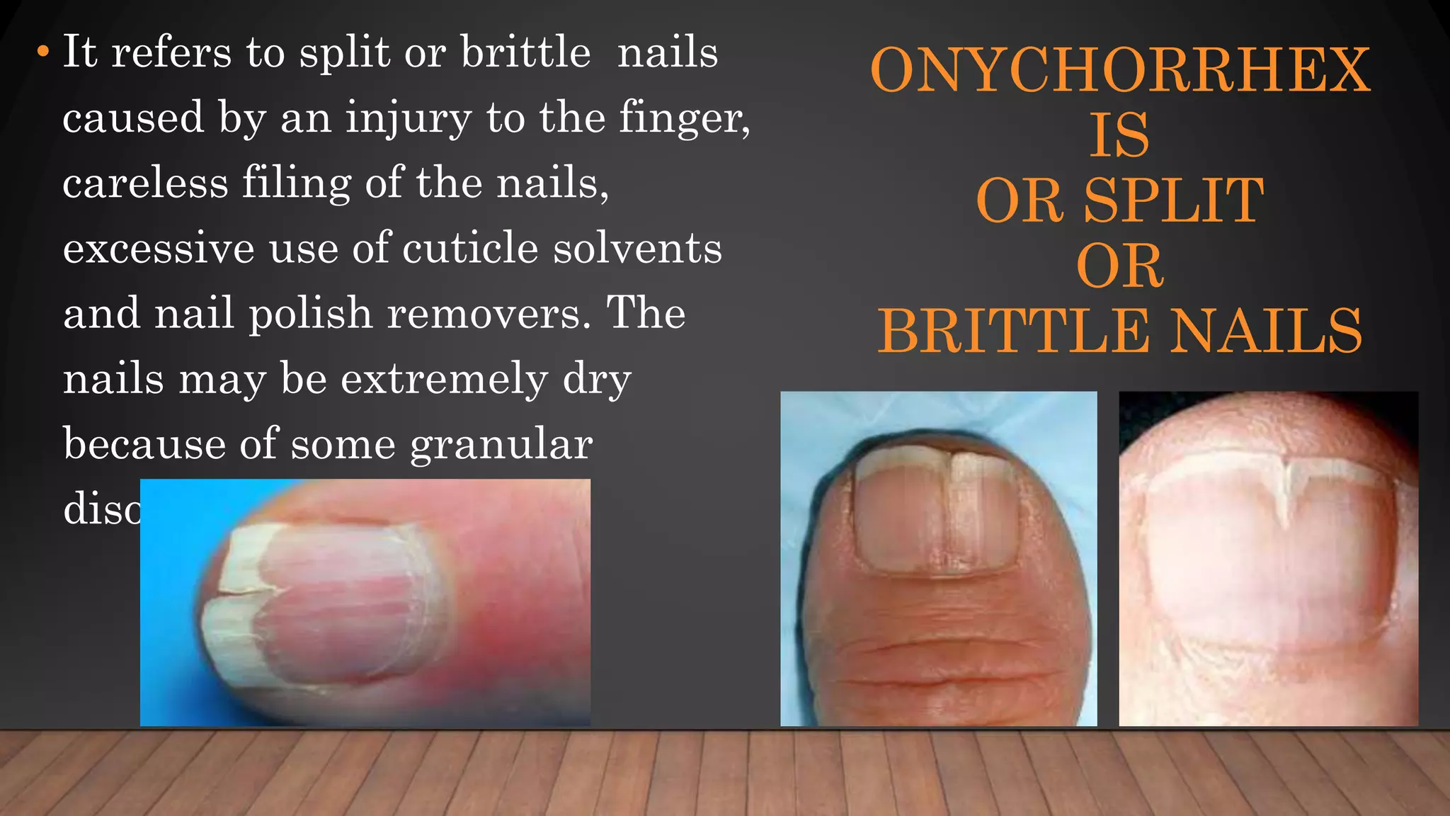 Nail diseases and disorders | PPTX