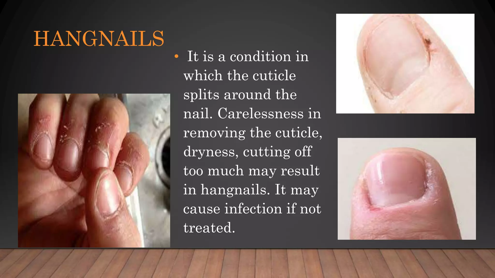 Nail diseases and disorders | PPTX