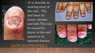 Nail diseases and disorders | PPT