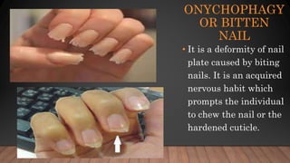 Nail diseases and disorders | PPT