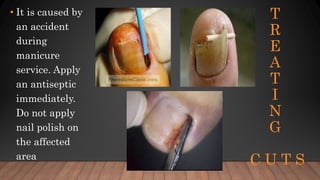 Nail diseases and disorders | PPT