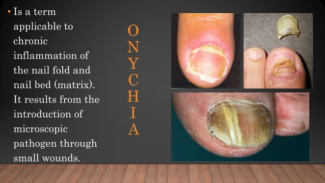 Nail diseases and disorders