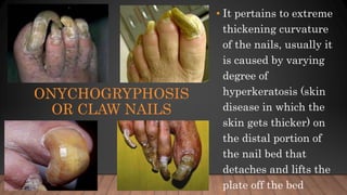 Nail diseases and disorders | PPT