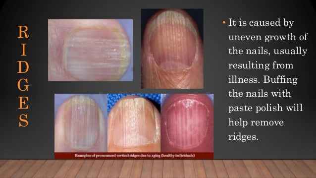 Nail diseases and disorders