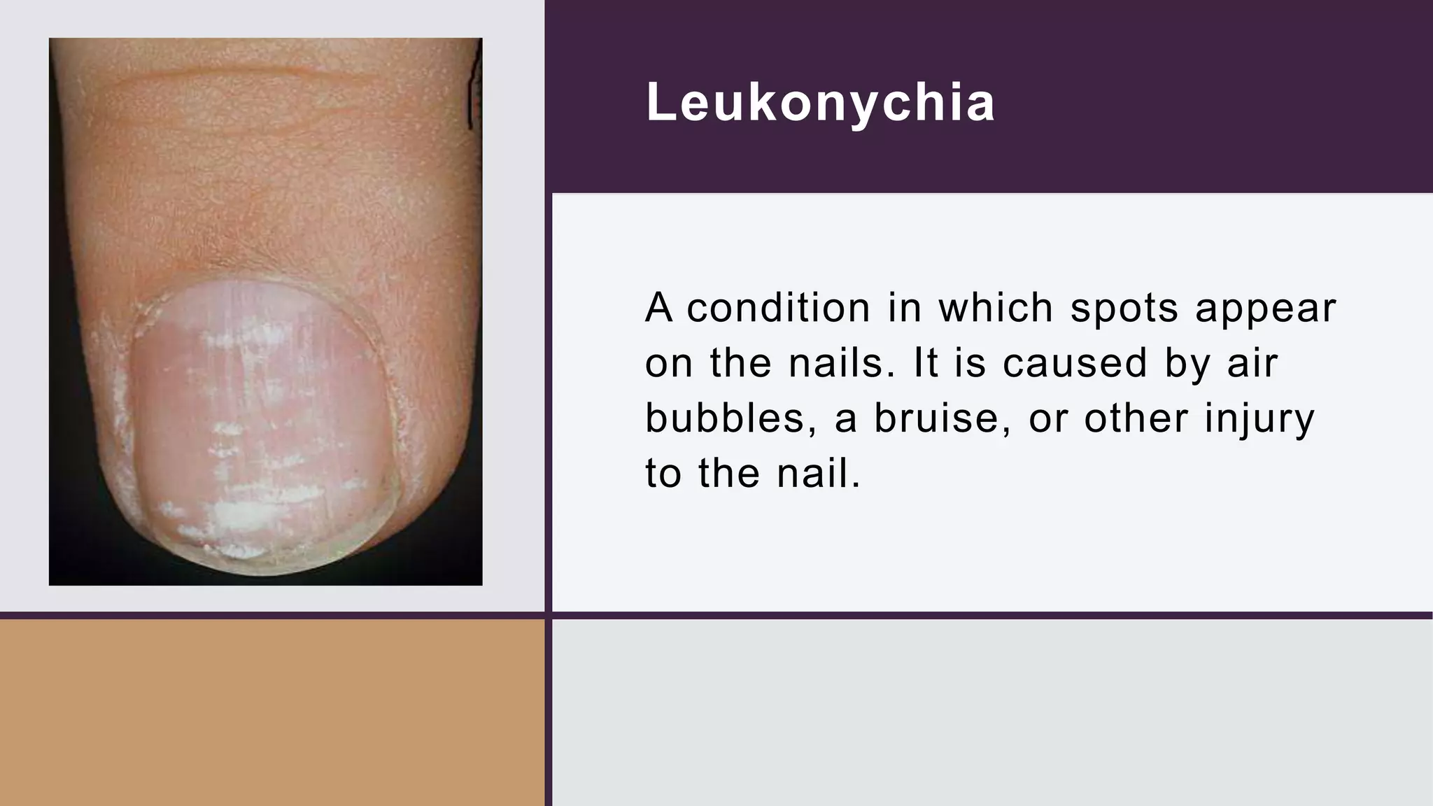 Nail Diseases and Disorders.pptx