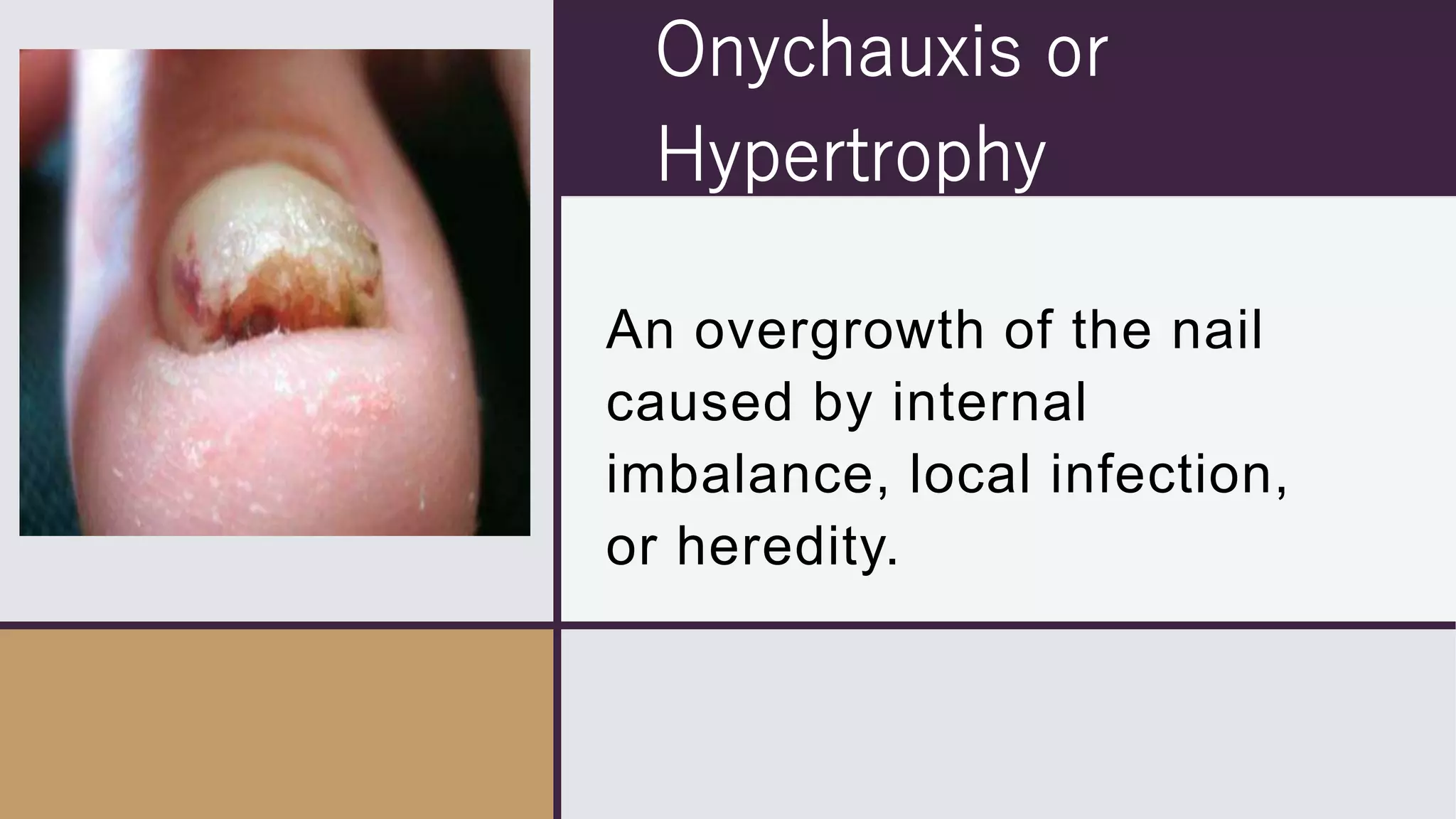 Nail Diseases and Disorders.pptx