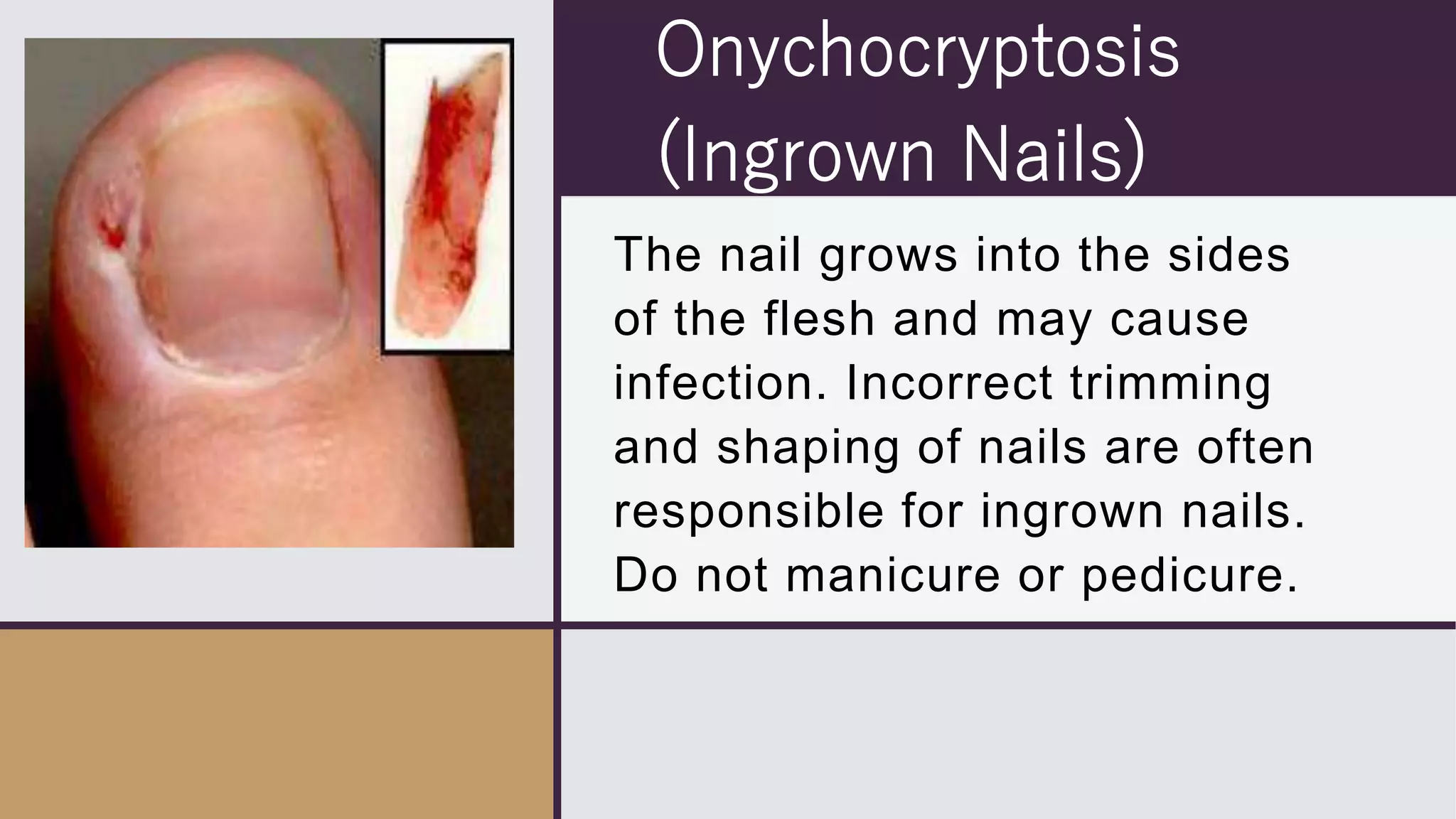 Nail Diseases and Disorders.pptx