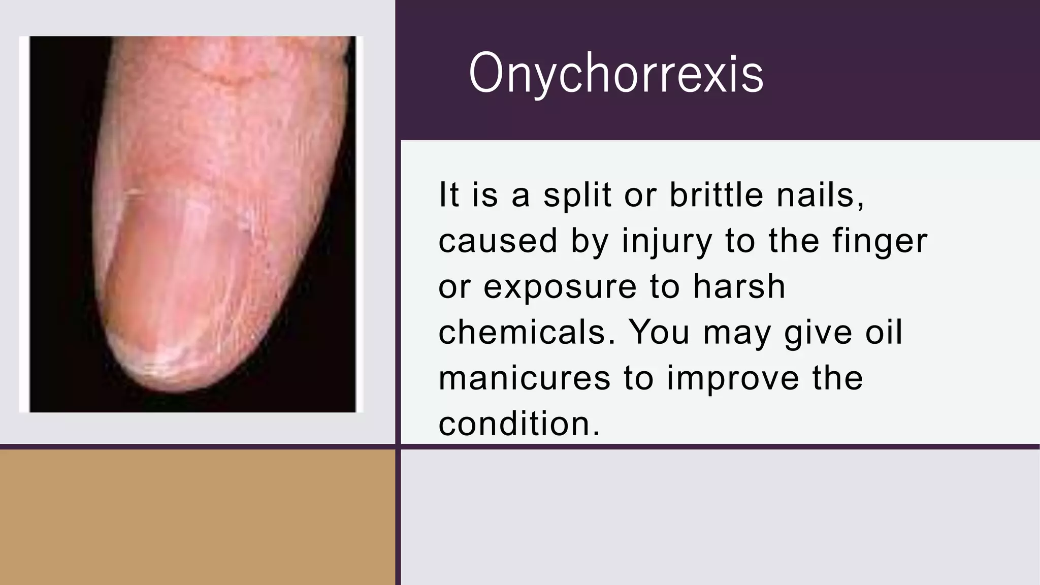 Nail Diseases and Disorders.pptx