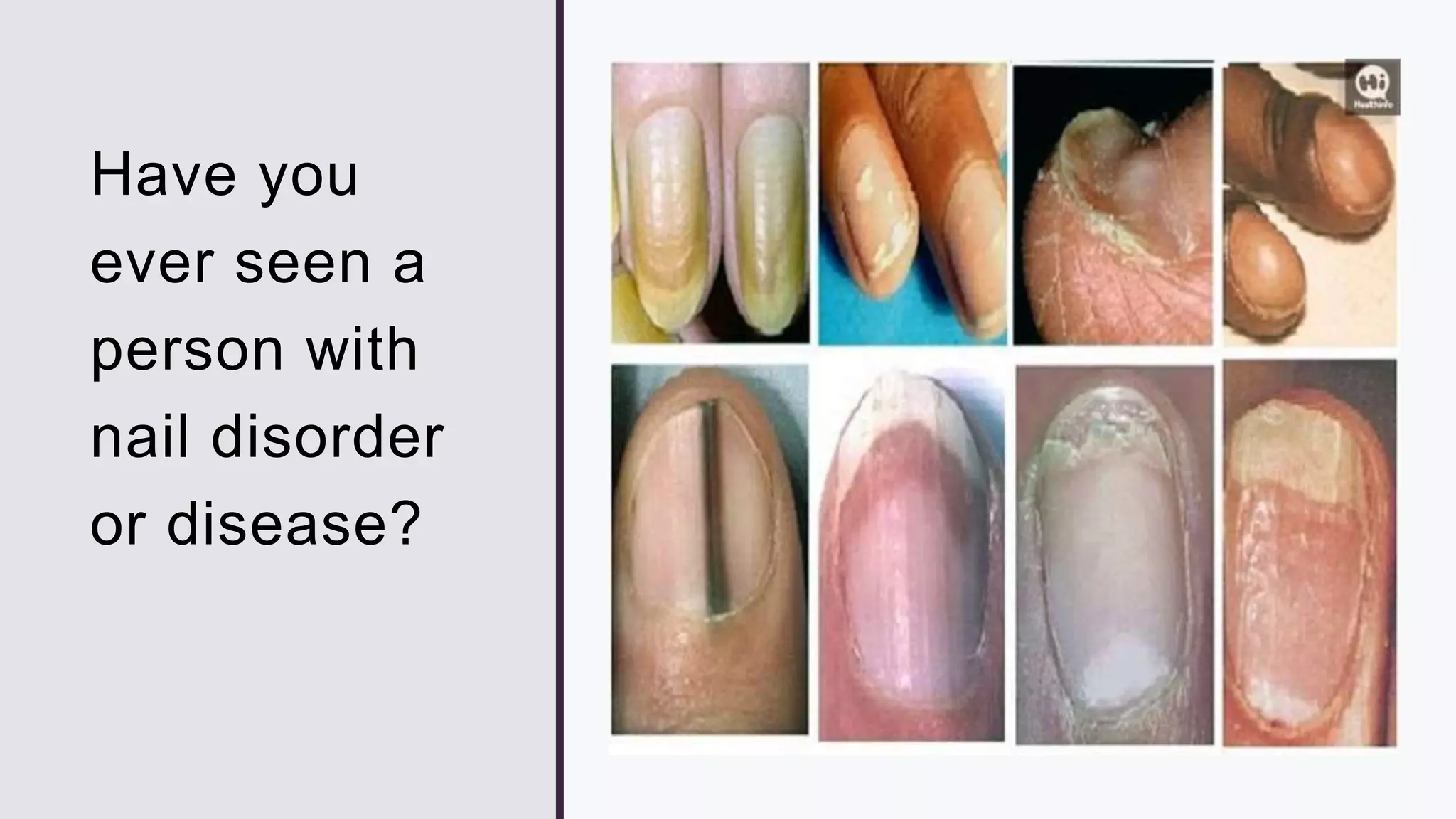 Nail Diseases and Disorders.pptx