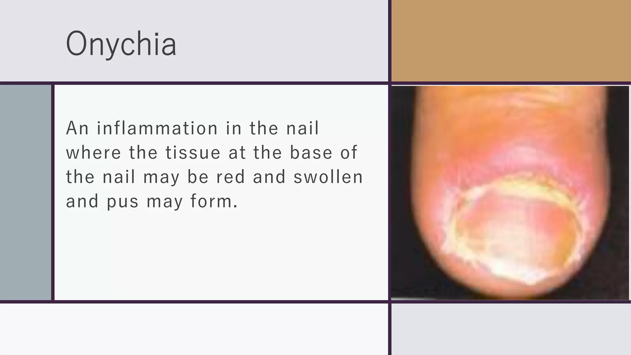Nail Diseases and Disorders.pptx