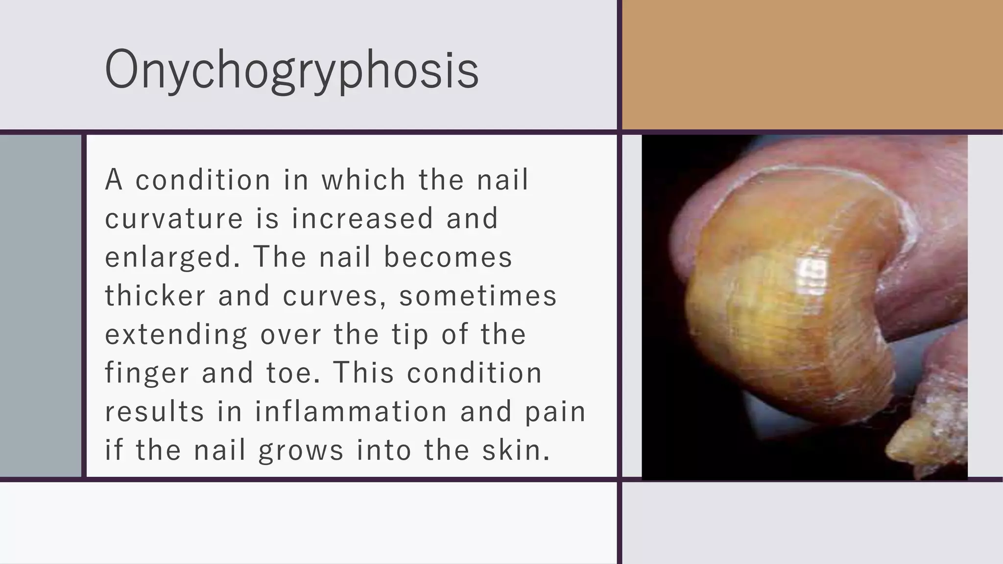 Nail Diseases and Disorders.pptx
