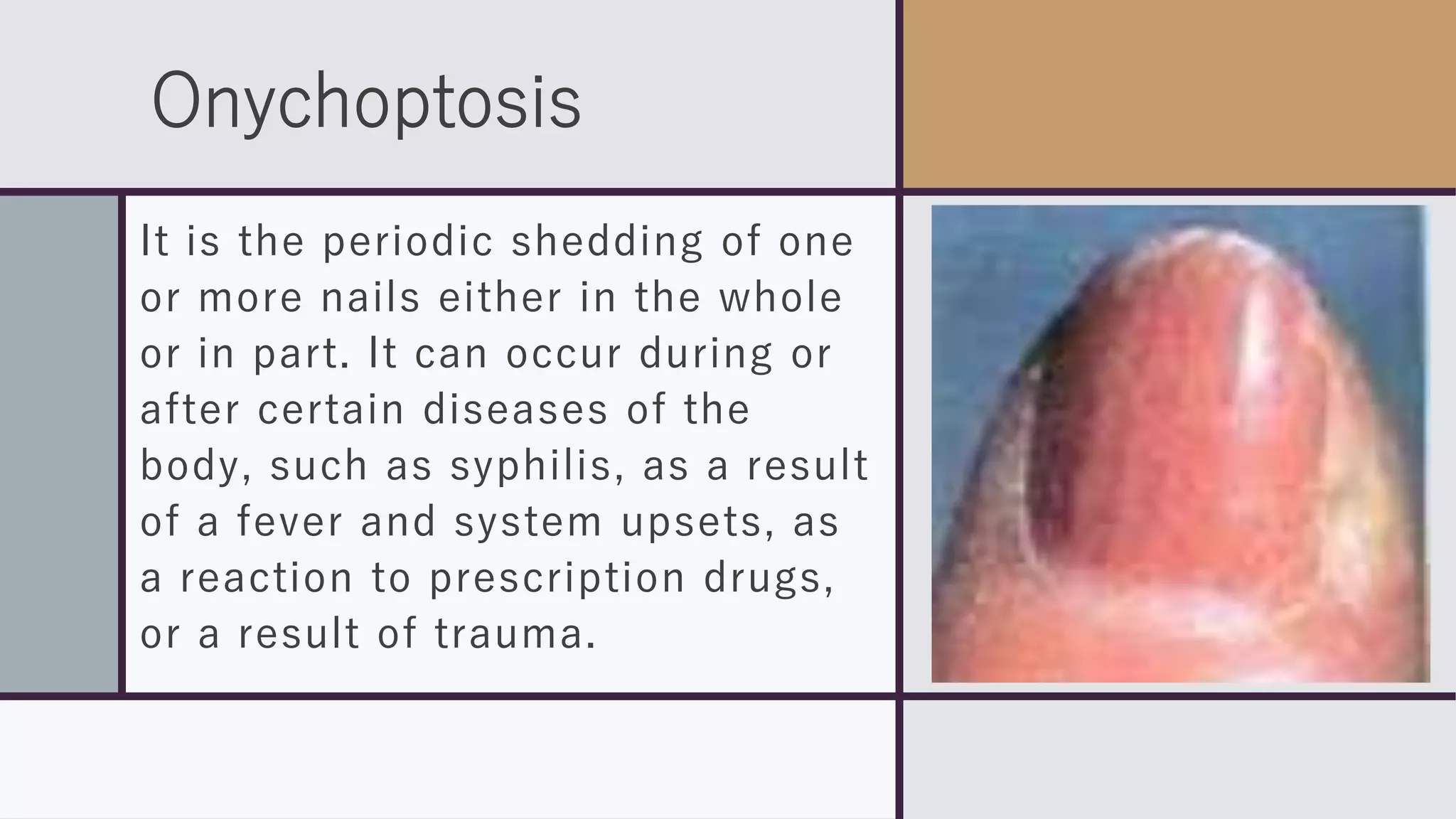 Nail Diseases and Disorders.pptx