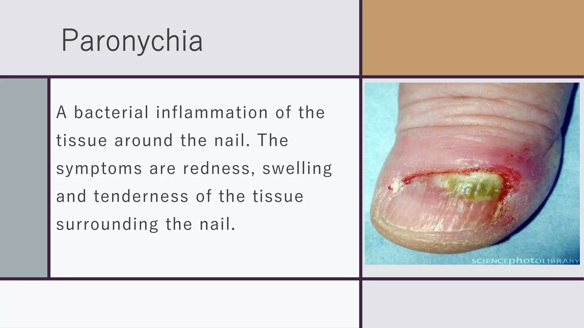 Nail Diseases and Disorders.pptx