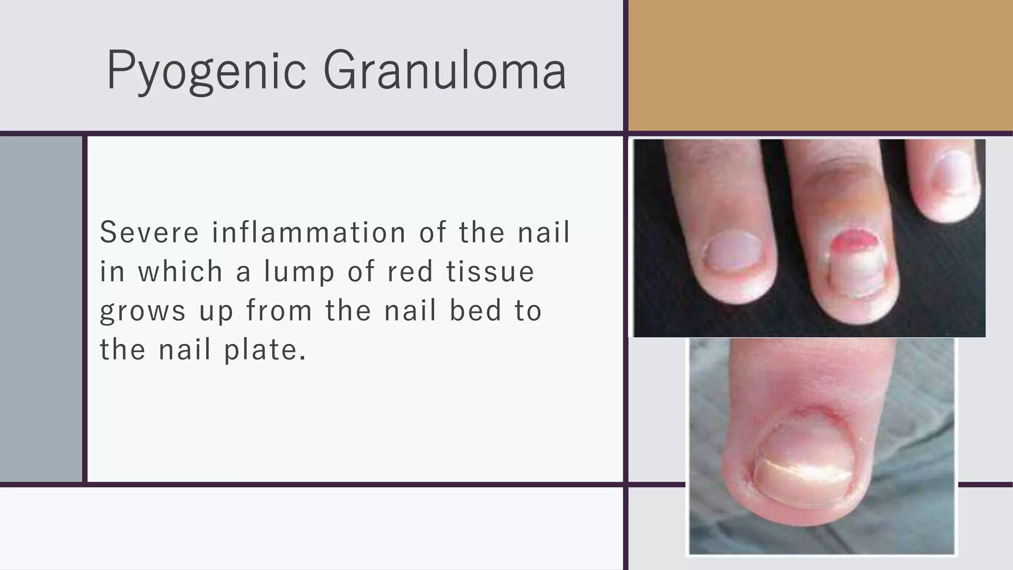Nail Diseases and Disorders.pptx