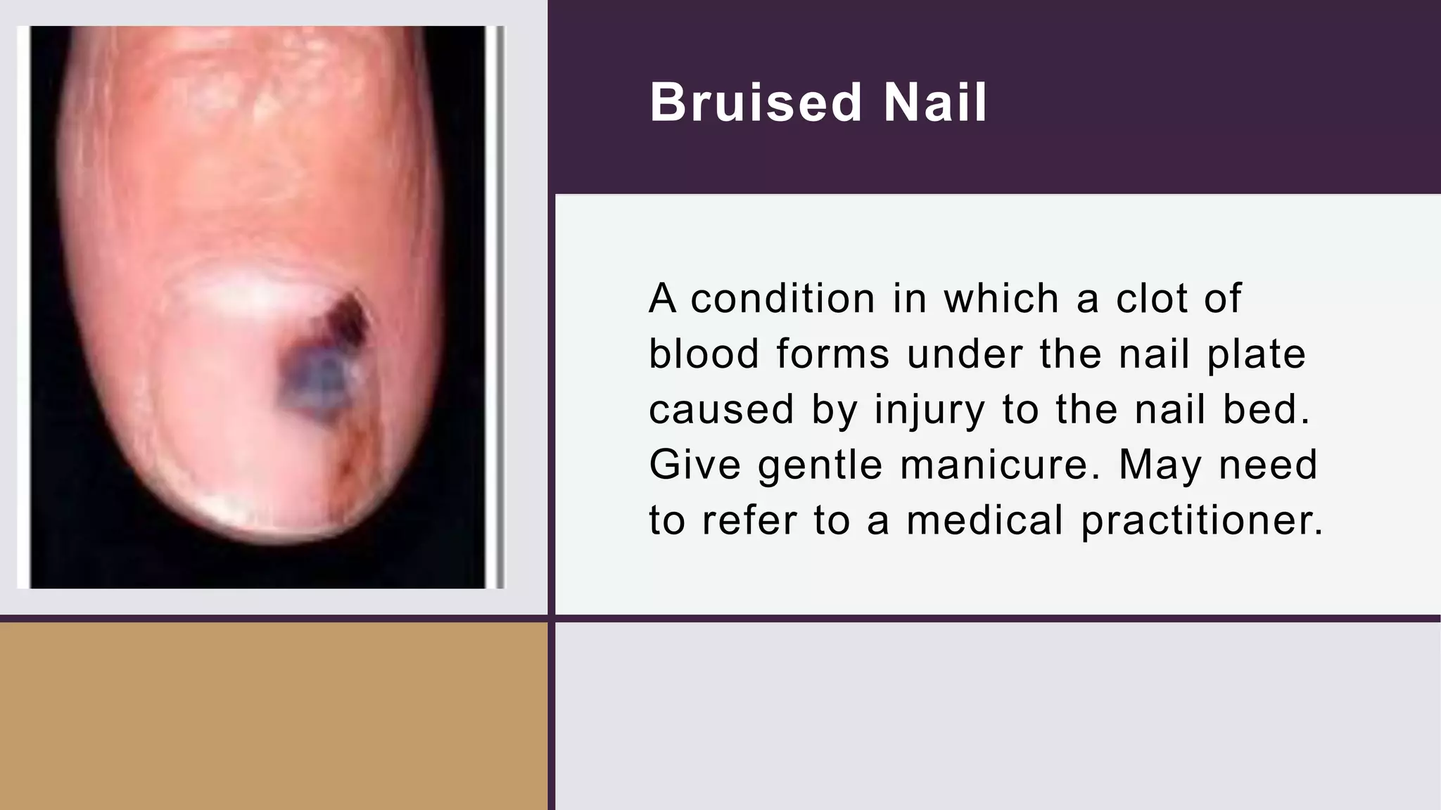 Nail Diseases and Disorders.pptx