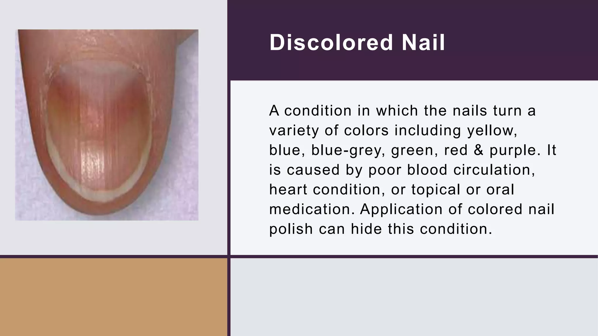 Nail Diseases and Disorders.pptx