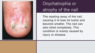 Nail Diseases and Disorders.pptx