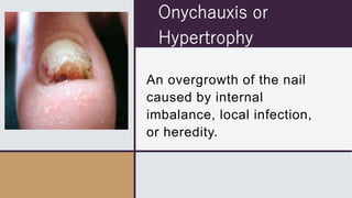 Nail Diseases and Disorders.pptx