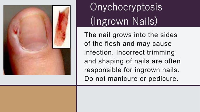 Nail Diseases and Disorders.pptx