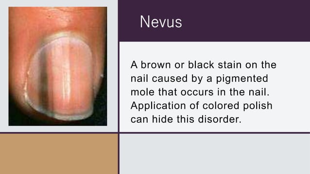 Nail Diseases and Disorders.pptx