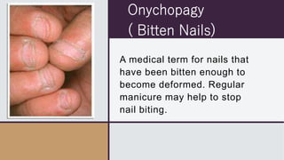 Nail Diseases and Disorders.pptx
