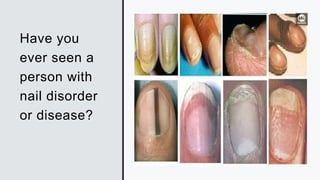 Nail Diseases and Disorders.pptx