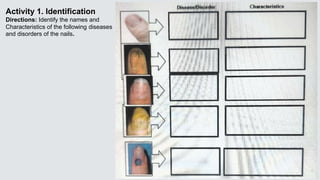 Nail Diseases and Disorders.pptx