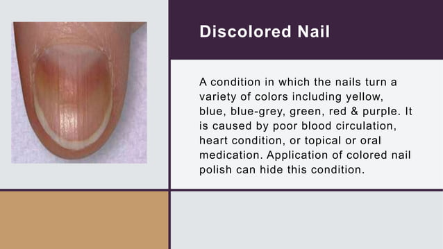 Nail Diseases and Disorders.pptx