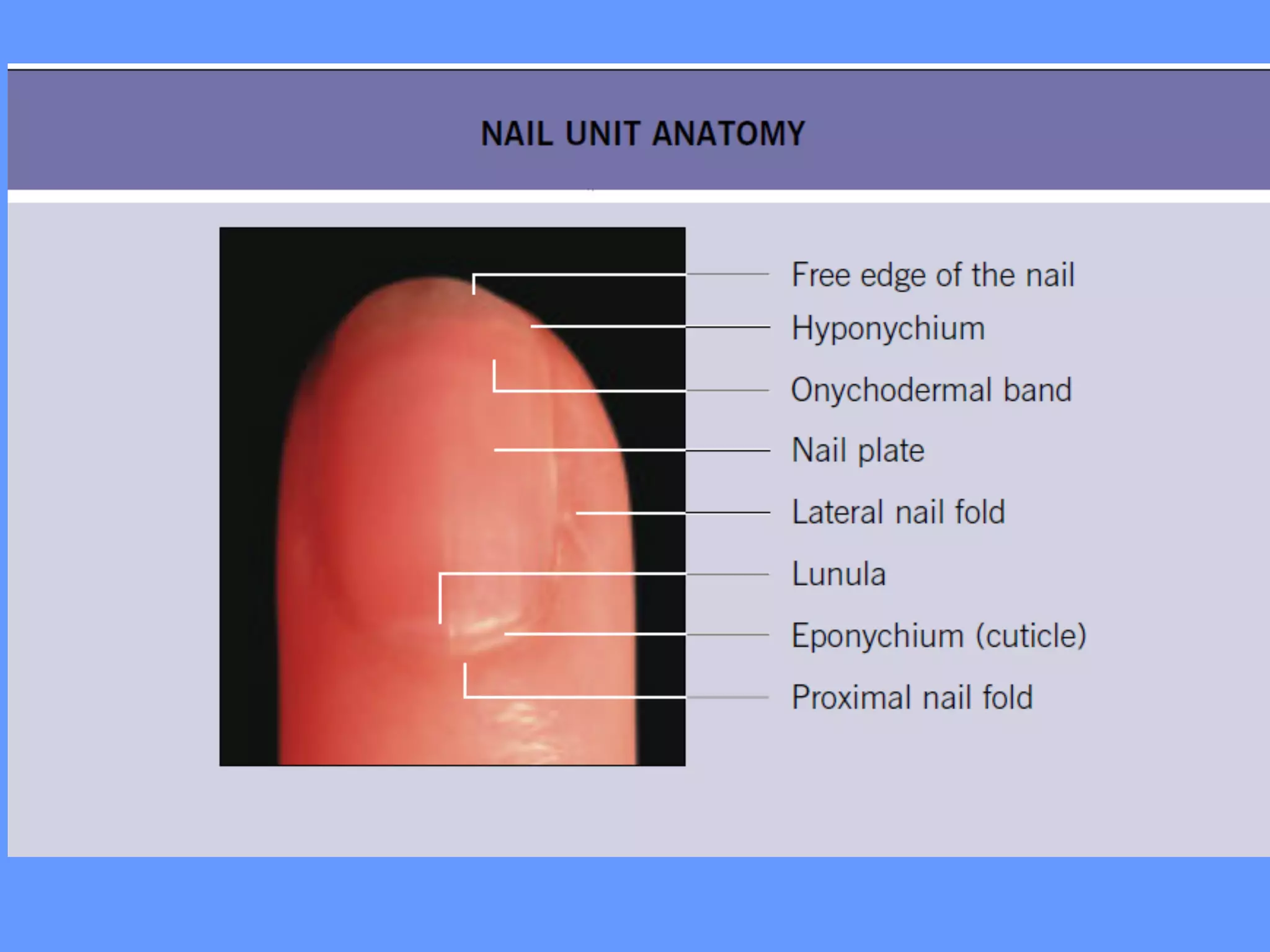 Nail disorder - Dr Aisha Almoosa | PDF