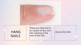 NAIL DISORDER TOPIC FOR GRADE 9 STS.pptx