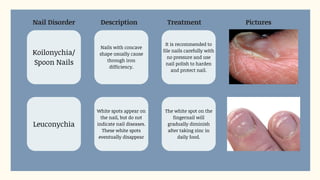 NailDisorder/ Nail Structure(Abigail DelasAlas)-pdf | PPT