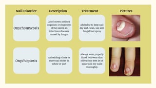 NailDisorder/ Nail Structure(Abigail DelasAlas)-pdf | PPT