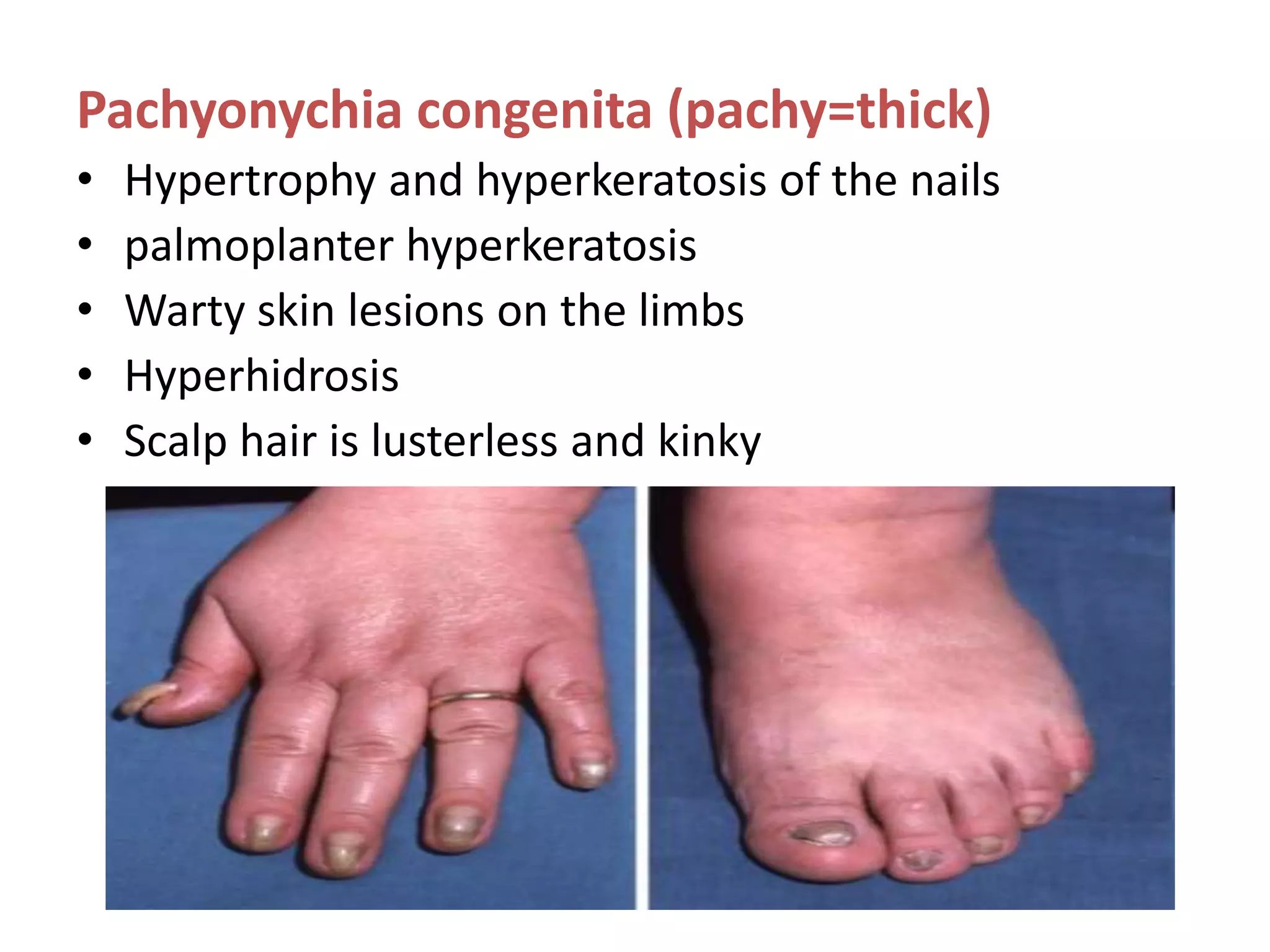 Nail disorder fahad albedaiwi | PPTX