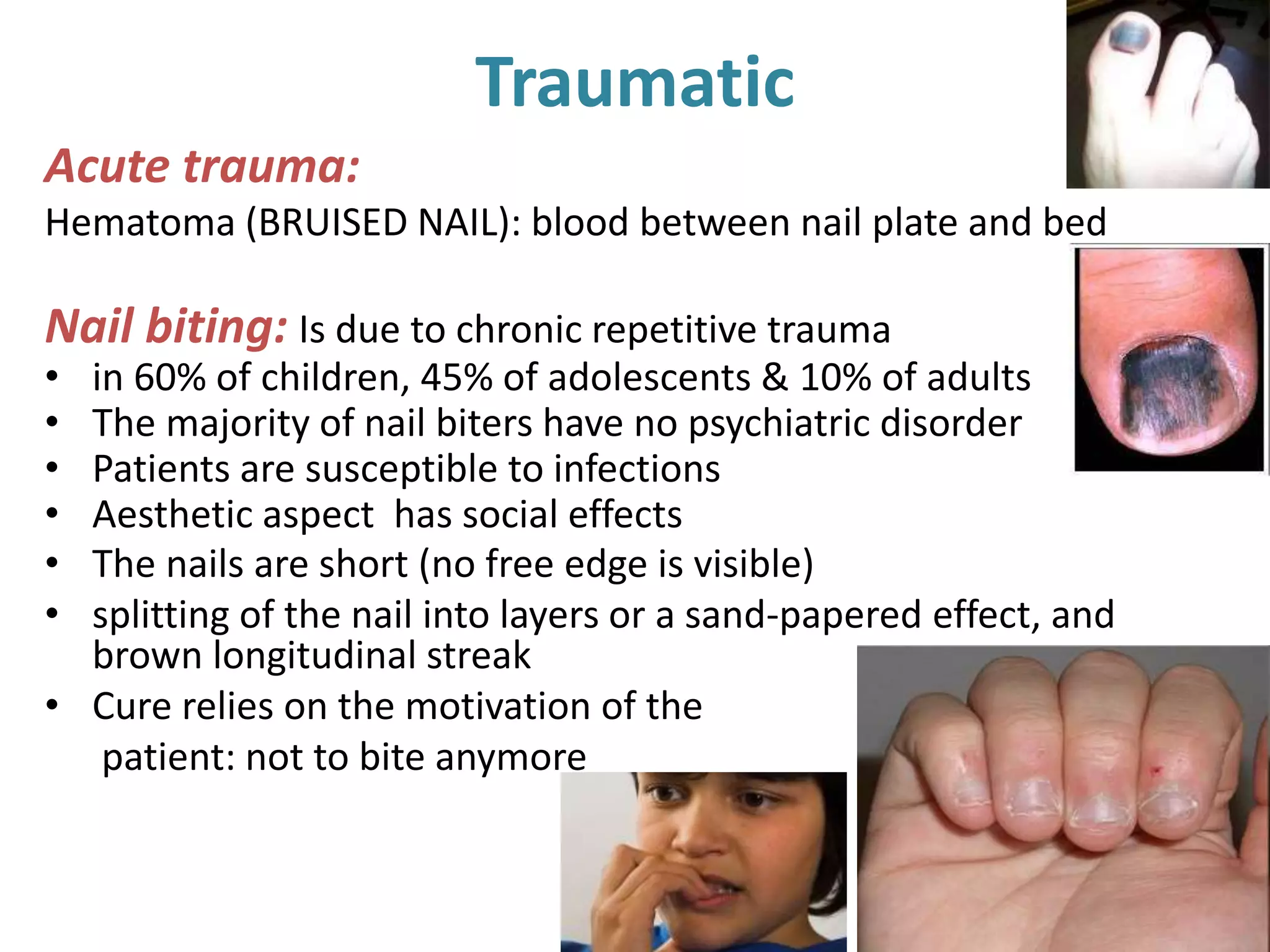 Nail disorder fahad albedaiwi | PPTX