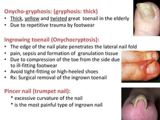 Nail disorder fahad albedaiwi | PPT