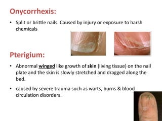 Nail disorder fahad albedaiwi | PPTX