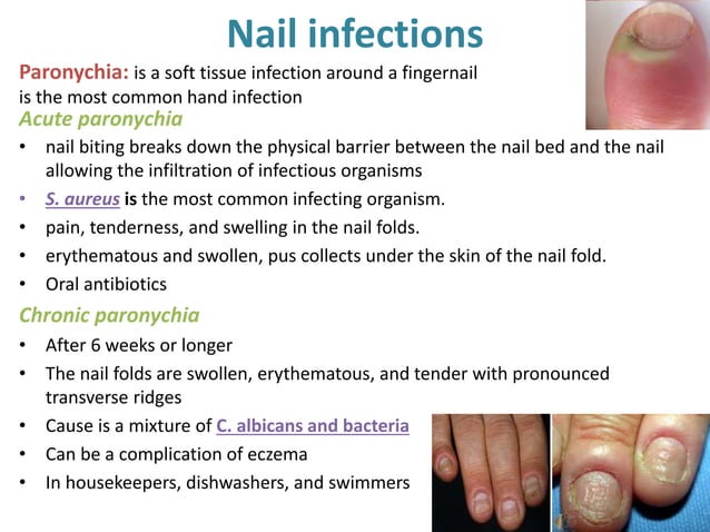 Nail disorder fahad albedaiwi | PPTX | Foot Health | Diseases and ...