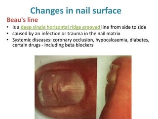 Nail disorder fahad albedaiwi | PPTX
