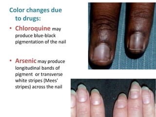 Nail disorder fahad albedaiwi | PPT
