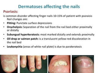 Nail disorder fahad albedaiwi | PPT