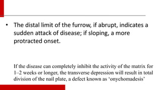 Nail Disorders Dr.mahar almorish dermatology.pptx