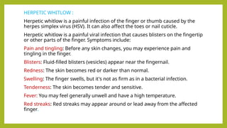 NAIL DISORDERS.pptx. powerpoint presentation | PPTX