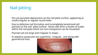 NAIL DISORDERS.pptx. powerpoint presentation | PPTX